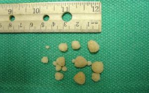 Recognizing & Treating Bladder Stones In Dogs - Snodgrass Veterinary ...